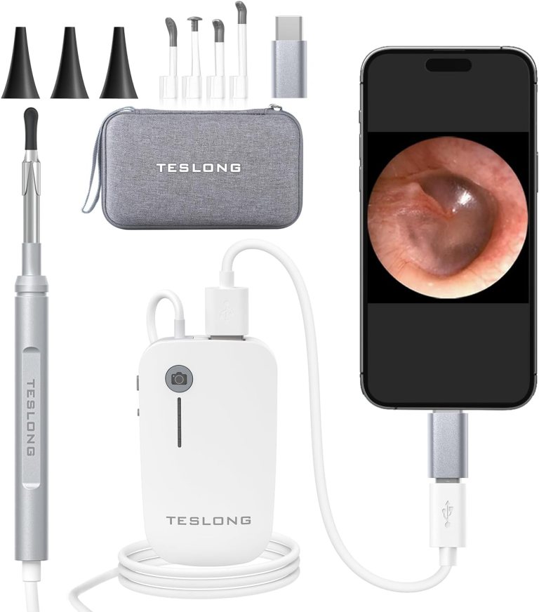 5 Best Ear Cameras (Top Otoscopes)